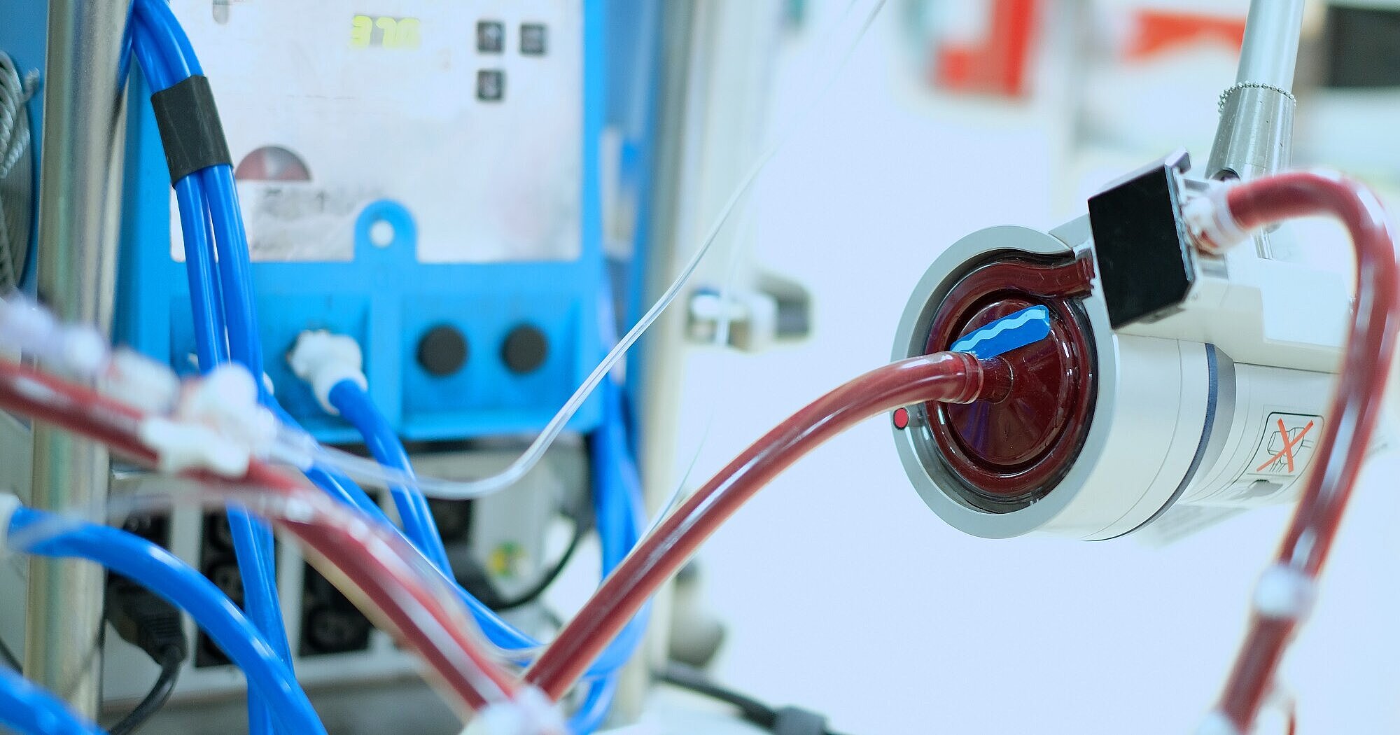 Making Patient Monitoring More Intelligent with Ultrasound